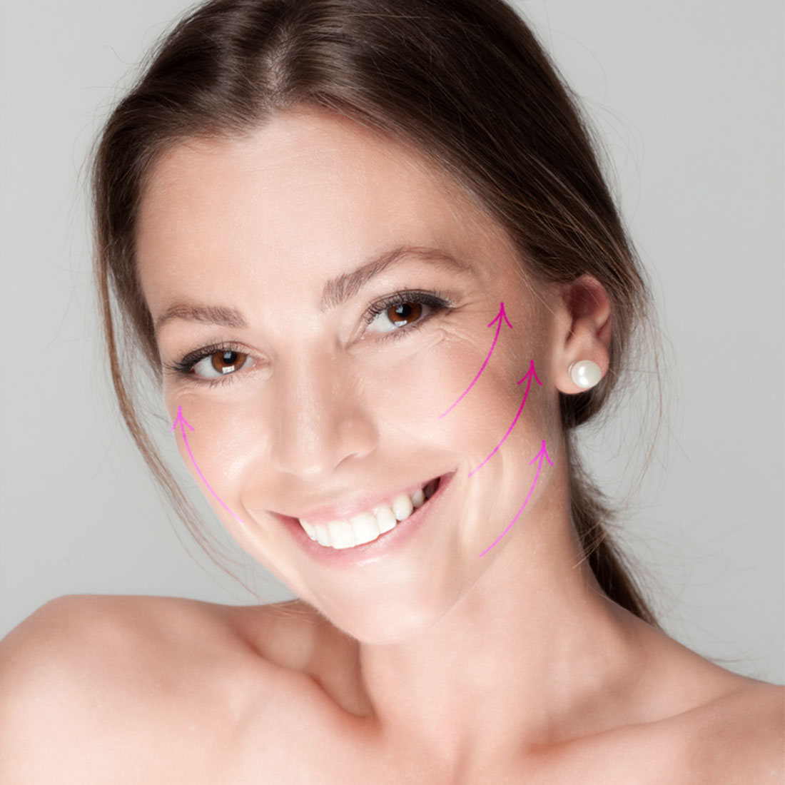 10 points 10 minutes Facelift - Dr. Ahmet Karaçam | Nişantaşı